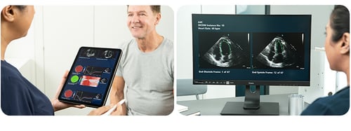 EchoGo Core 2.0: Next generation AI platform offers faster, more robust ...