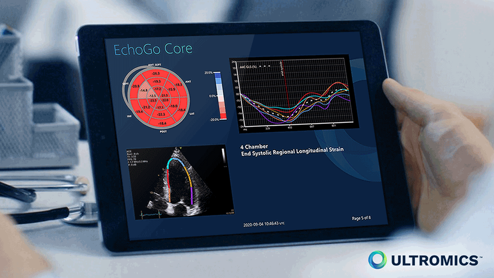 Top 6 benefits of cloud for echocardiography analysis - Ultromics