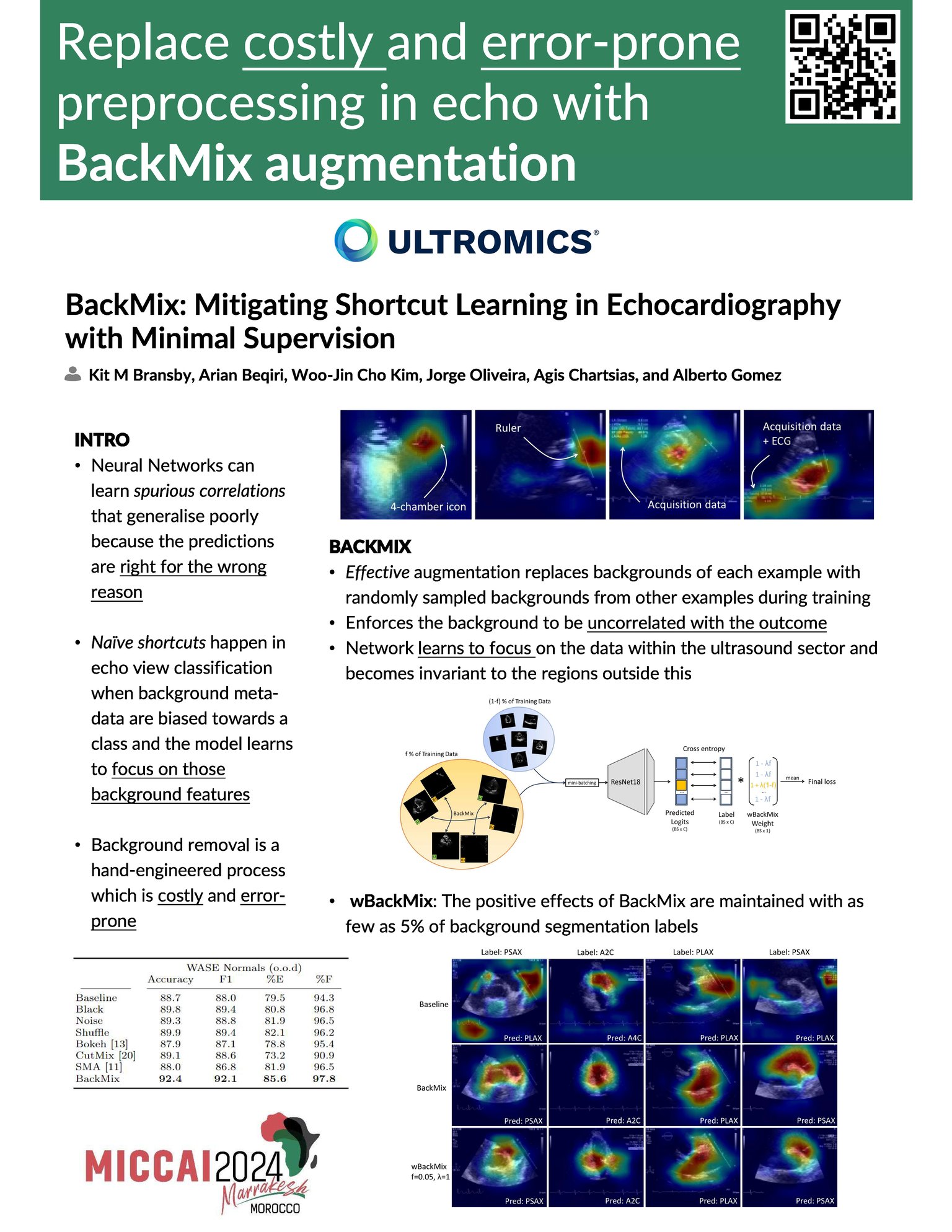 BackMix: Mitigating Shortcut Learning In Echocardiography With Minimal ...
