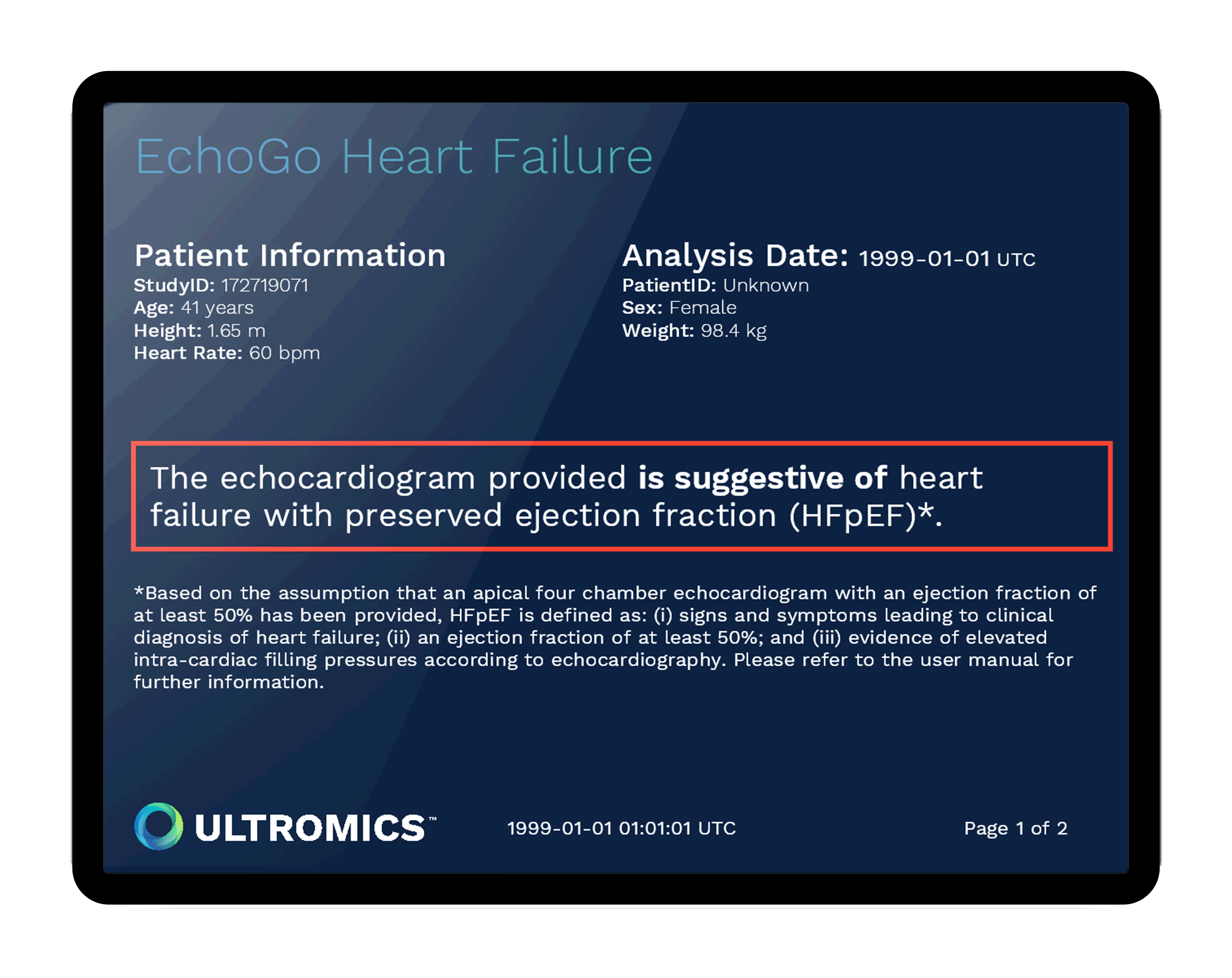 Next-generation Echocardiography is here - Ultromics Next-generation Echocardiography is here - Ultromics